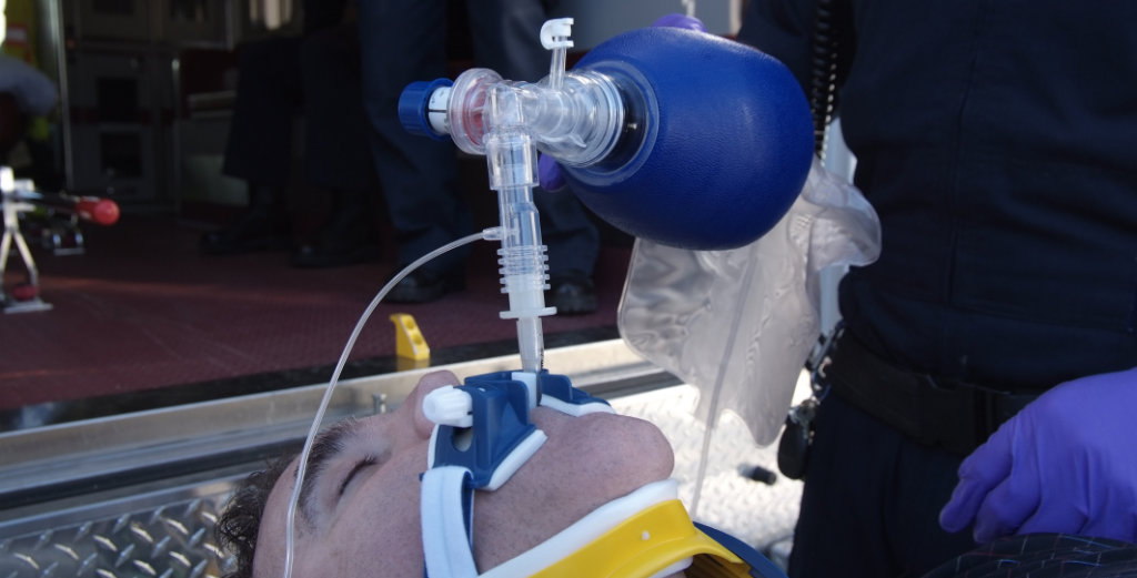 Basisbeginselen: Wat is het, hoe werkt het en hoe wordt het gebruikt? – KAP = CAPNO