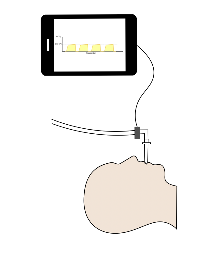 Basisbeginselen: Wat is het, hoe werkt het en hoe wordt het gebruikt? – KAP = CAPNO