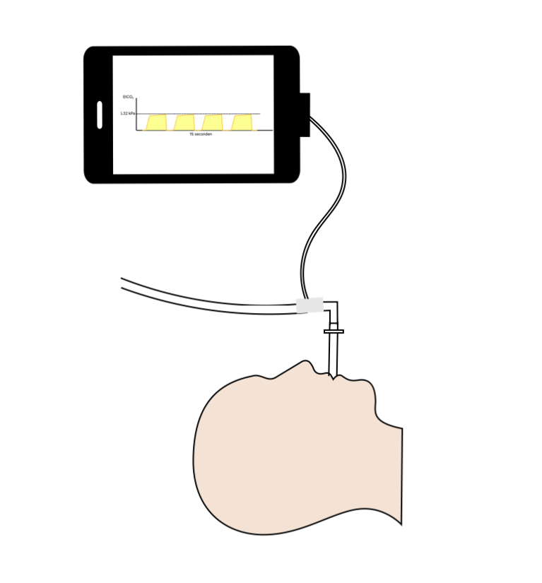Basisbeginselen: Wat is het, hoe werkt het en hoe wordt het gebruikt? – KAP = CAPNO